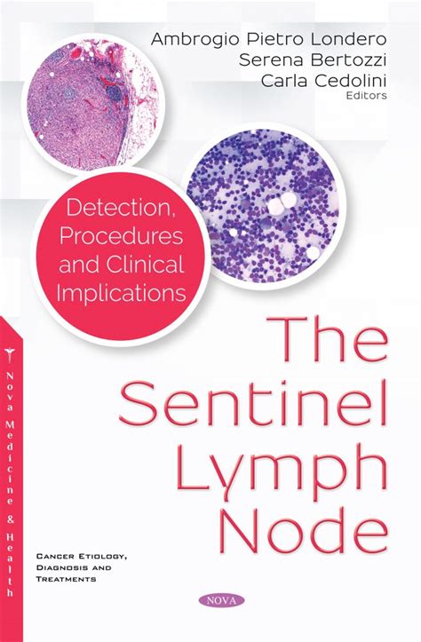 The Sentinel Lymph Node Detection Procedures And Clinical