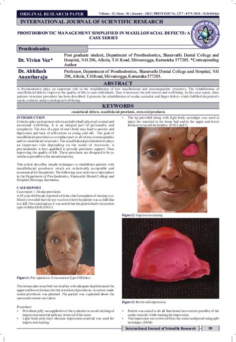 Pdf Original Research Paper Prosthodontic Management Simplified In