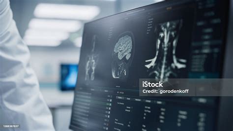 의료 병원 신경과 의사와 신경 외과 의사 이야기 컴퓨터 사용 환자 Mri 스캔 분석 뇌 진단 뇌 수술 건강 클리닉 실험실 Ct