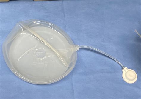 St Stage Scalp Expander Placement For Large Custom Skull Implants Explore Plastic Surgery