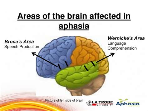 Ppt Increasing Community Awareness Of Aphasia Powerpoint Presentation