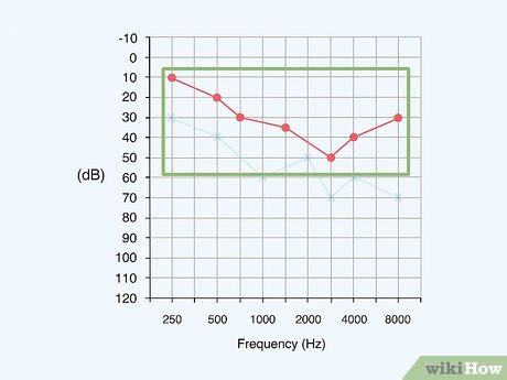 How To Read An Audiogram Steps With Pictures WikiHow