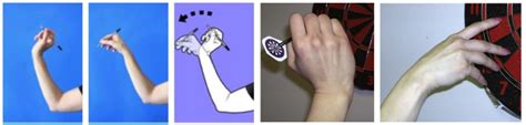 Splint In The Spotlight Dart Throwers Motion Orthosis Also Known As