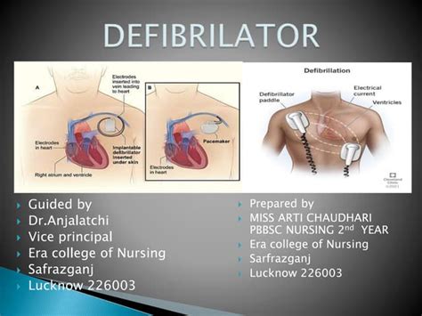 Automated External Defibrillator Pptx