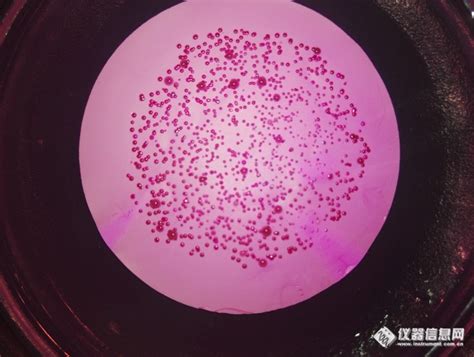 大肠杆菌菌落平板大肠杆菌平板第17页大山谷图库