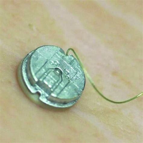 An Intact TASER 7 Probe With Its Shaft Fully Embedded In Tissue Download Scientific Diagram