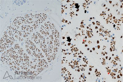 Peripheral Nerve Axons Neuro Notes Arkana Laboratories