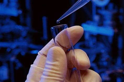 New Urine Test Might Predict Aggressiveness Of Prostate Cancer