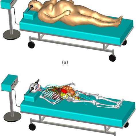 The Electrode Placement Considered A Bilateral Bl B Right