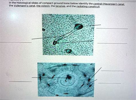 Solved In The Histological Slides Of Compact Ground Bone Below