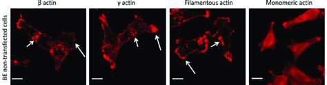 Subcellular Organization Of β And γ Actins As Well As Filamentous And