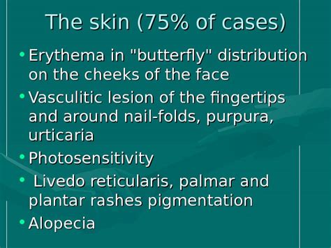 Diffuse Diseases Of Connective Tissue Ddct Definition