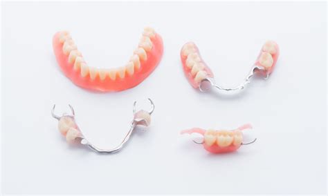 How To Restore Missing Teeth Dentist In Roslyn Heights
