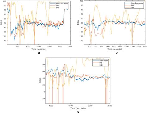 Comparisons Of The New Index And The Bis Index With Sqi A Patient Id