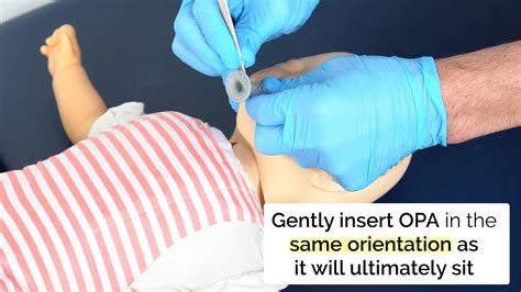 Oropharyngeal Airway Guedel Airway Insertion Osce Guide Geeky Medics