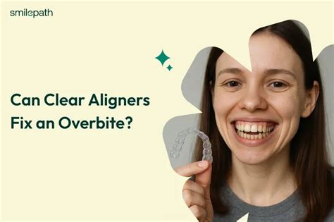 How Aligners Correct An Overbite Effectively