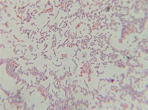 Dense Clumps Of Rod Shaped Bacteria Bacilli Under A Microscop Stock