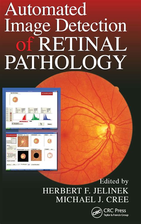 Automated Image Detection Of Retinal Pathology 1st Edition Premiumjs
