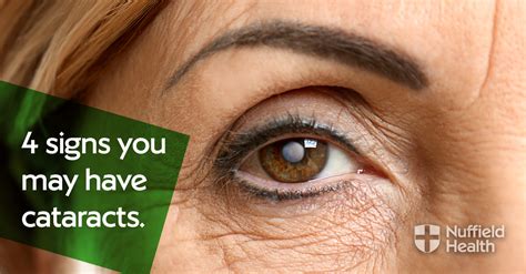 Cataracts Symptoms Menopause At Bella Pflaum Blog