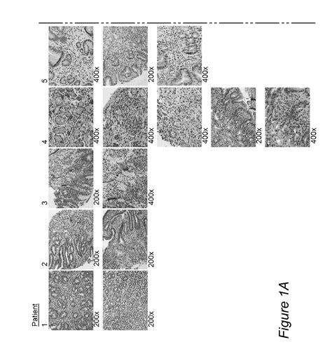 Molecular Diagnostic Panel Of Eosinophilic Gastrointestinal Disorders