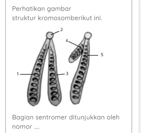 Perhatikan Gambar Struktur Kromosom Berikut Ini Gambar Menunjukkan Struktur Kromosom Dengan