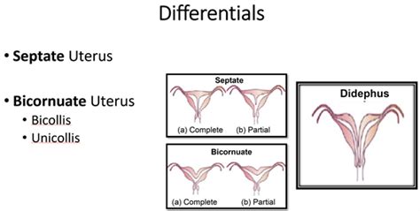 Uterus Didelphys Pregnancy