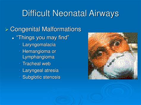 PPT The Neonatal Airway And Neonatal Intubation PowerPoint Presentation ID 1206123