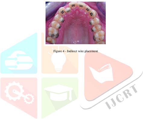 figure 4 from artificial intelligence in orthodontic diagnosis and