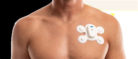 Wireless Cardiac Monitoring St Clares Medical Center Inc