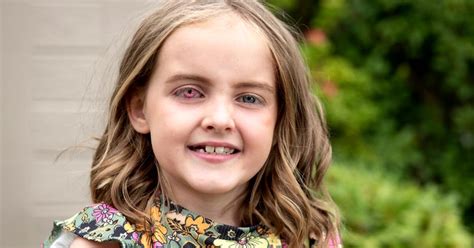 Pinkes Superhelden Auge Achtjährige Verblüfft Mit Kreativer Prothese