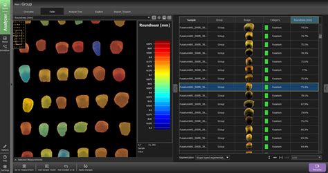 Shape Based Analysis Prediktera