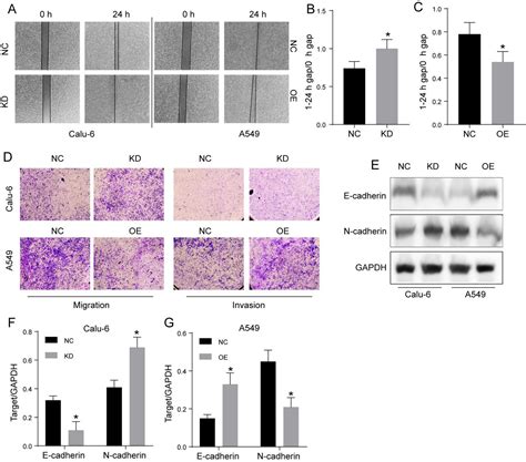 Downregulation Of Slc14a1 Expression Indicates Poor Prognosis And Promotes The Progression Of