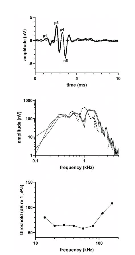 Top Click Evoked Abr Middle Frequency Spectrum Of The Abr Waveform