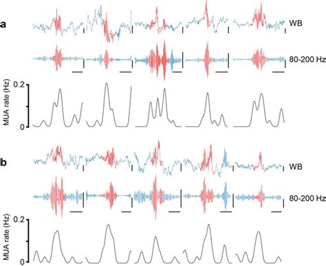 Sharp Wave Ripple Event Detection A Upper Traces Wb Show Five