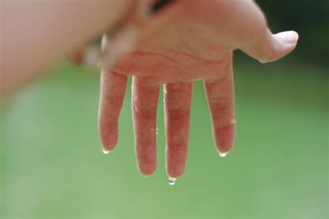 Hyperhidrosis Isnt Just A ‘sweaty Hands Problem — The Unexpected Places It Shows Up And What