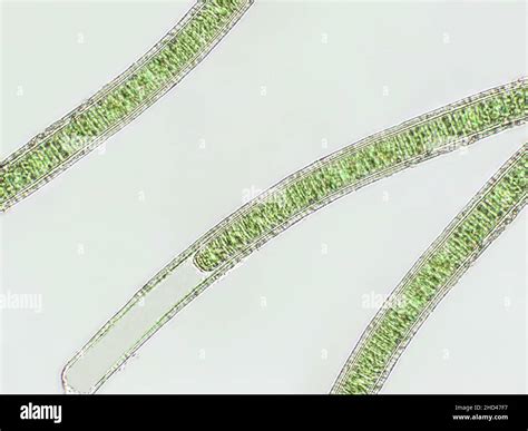 Oscillatoria Algae Under Microscopic View X40 Cyanobacteria Blue
