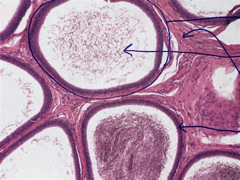 Ductus Epididymis Slide Aandp 2 Review Diagram Quizlet