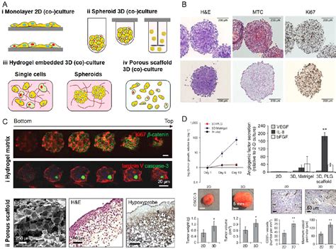 Figure 1 From Bioprinting The Cancer Microenvironment Semantic Scholar