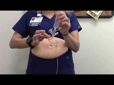 How To Use A G Tube Moffitt Cancer Center Youtube