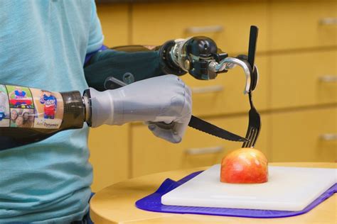 Activities Of Daily Living Adls For People With An Upper Limb Difference