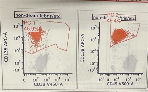 Plasma Cell Leukemia Flow Cytometry Analysis R Medlabprofessionals