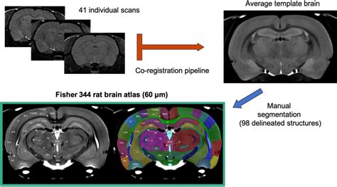 an mri derived neuroanatomical atlas of the fischer 344 rat brain for