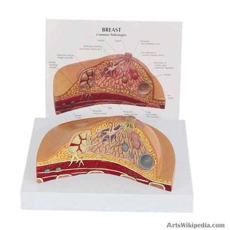 Real Human Size Median Section Model Of Human Female Breast Pathology
