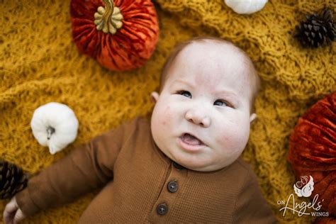 What Are Trisomy 13 And Trisomy 18 On Angels Wings