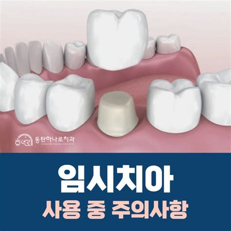 동탄하나로치과 동탄하나로치과 👨‍⚕️🦷👉치아 상실의 주요 원인 치주질환과 잇몸치료에 대해 ️치주질환의 원인 1 치석 및