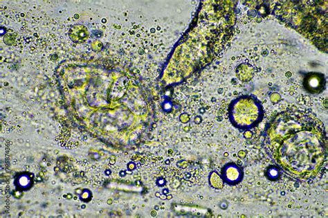 Green Mucus And Coughing Up Phlegm Under The Microscope Looking At Influenza Cells And Cold Snot