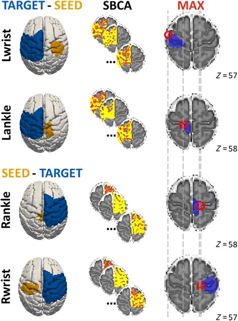 Results Of The Seed‐based Connectivity Analysis Sbca The Different