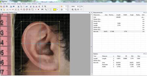 Measurement Of Ear Dimensions Using Digimizer Software Download