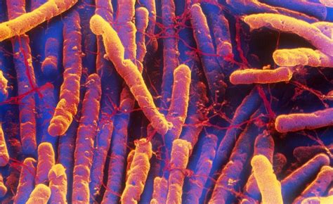 Clostridium Difficile Infection In The Intensive Care Setting Infectious Disease Advisor