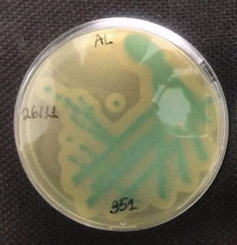 Listeria Monocytogenes Colonies After Cultivation On Tryptone Soya
